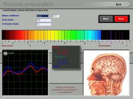 Nutriční poradenské centrum | Oberon Titanium | NLS diagnostika